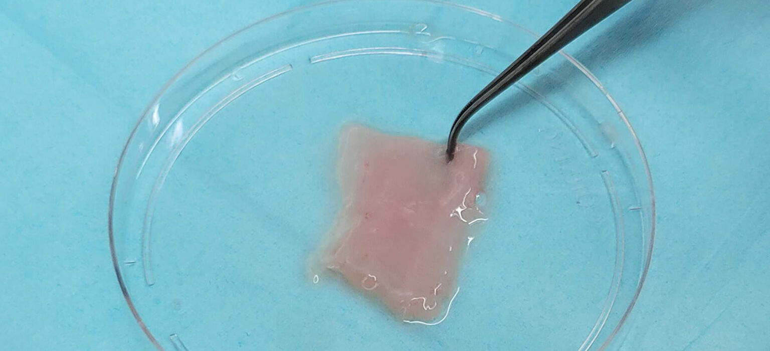 See the Full Potential of Cord Tissue with… | Americord Registry