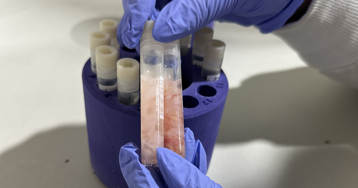 Cord Blood Collection: Safety Protocols Explained | Americord Registry