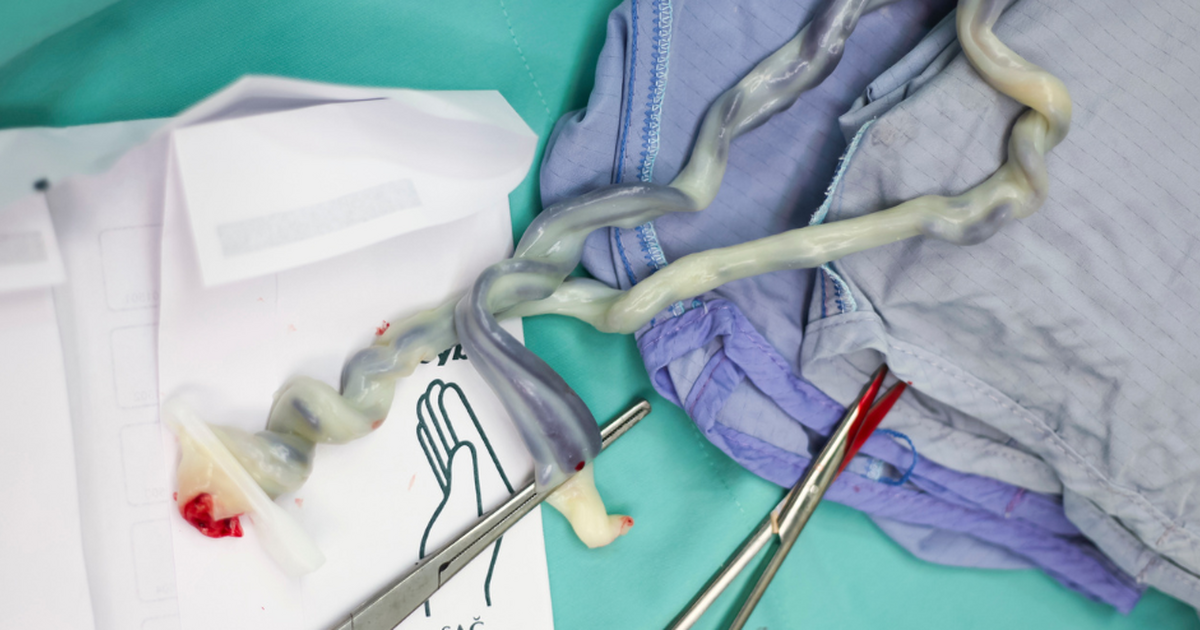 Cord Blood Banking vs. Cord Tissue Banking | Americord Registry