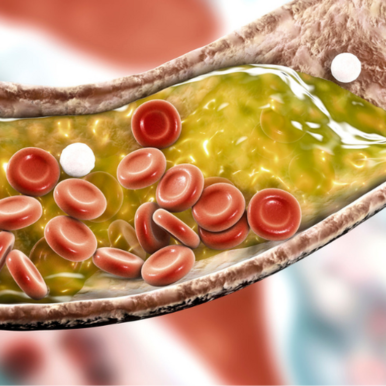 10 Things You Need to Know About Blood Cancer | Americord Registry