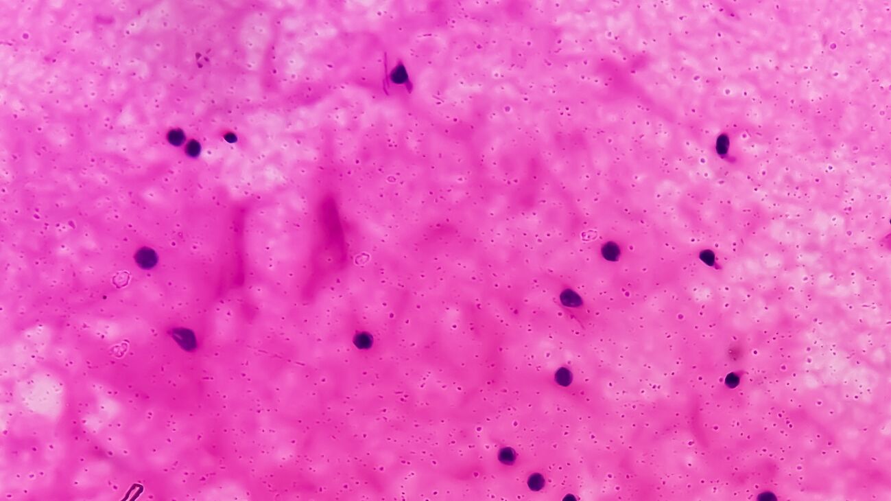 Advanced Tissue Cryostorage Services | Americord | Americord Registry